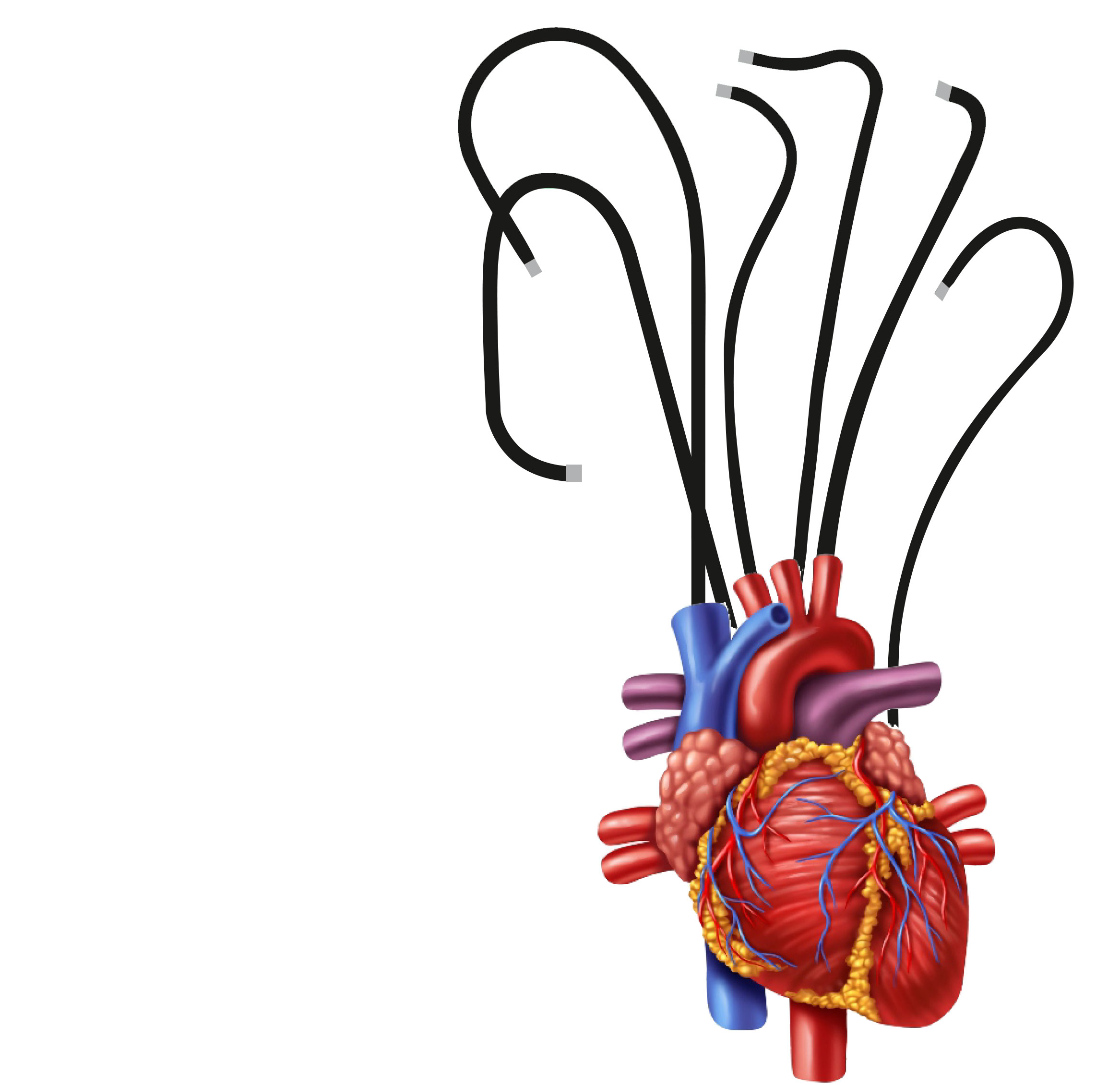 Kılavuz Kateter - Taha Biomedical